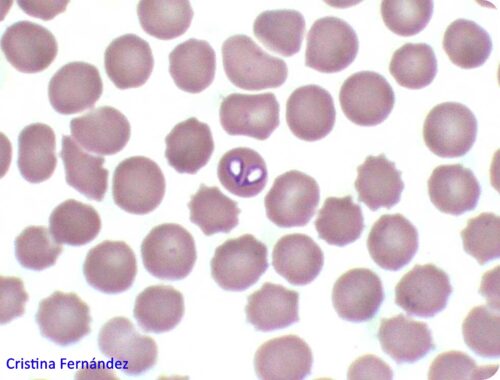 BABESIOSIS CANINA - Blog - Hospital Veterinario Ferral